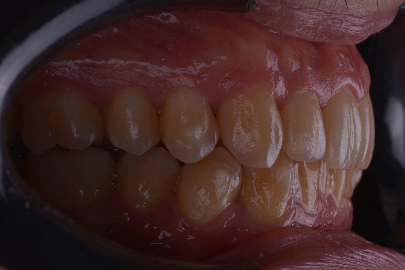 ¿Que flash comprar? Guía a los FLASHES en ODONTOLOGÍA