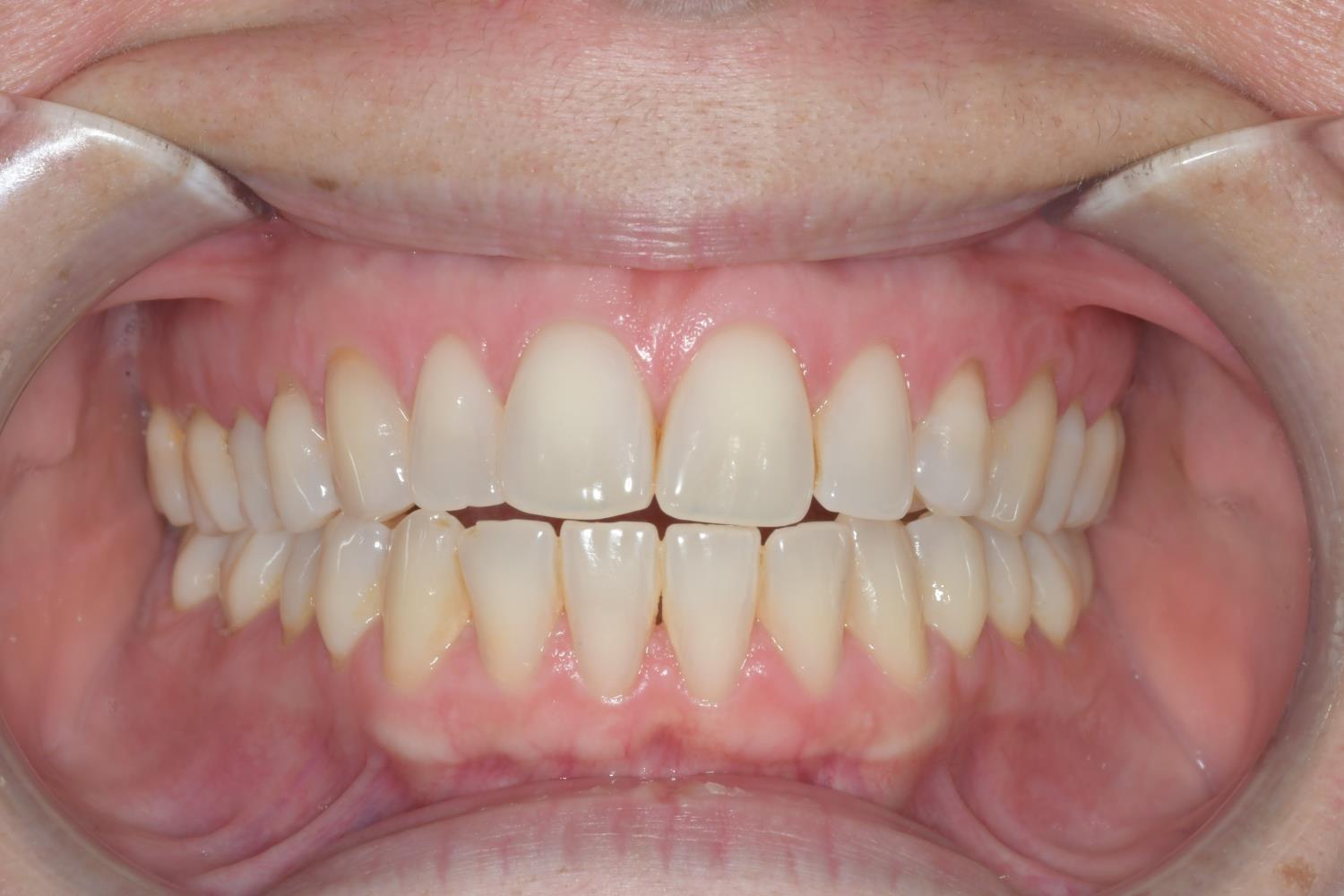 La importancia de la fotografía en odontología